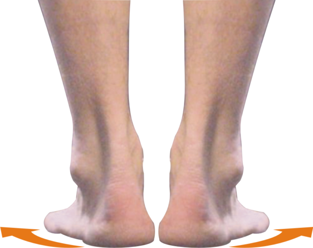 QUADRASTEP® Foot Orthotics - C Quad - Freed Foot